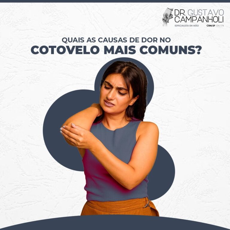 Dor nas Pernas: 5 Causas e Como Tratar | Doutor Gustavo Campanholi l ...